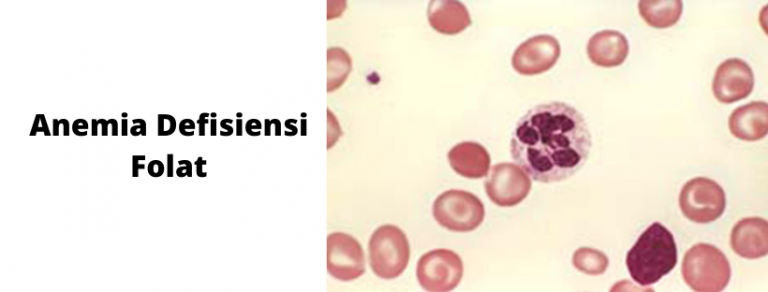 Anemia Defisiensi Folat - PT Indogen Intertama