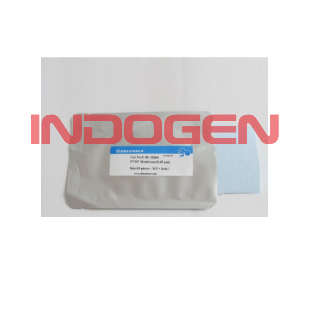 Prinsip Kerja Western Blotting (WB) dan Komponen yang Dibutuhkan ...