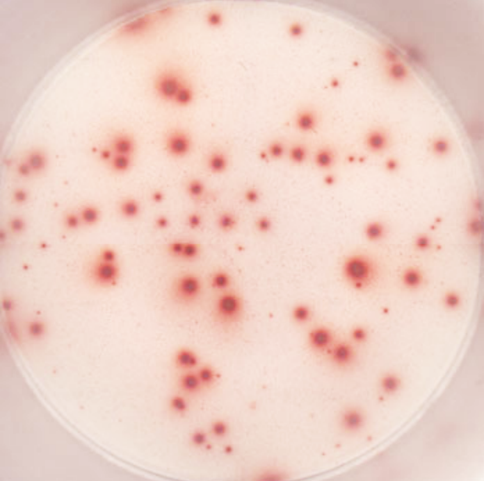 Mengenal Metode ELISPOT (Enzyme-Linked ImmunoSpot) dengan produk ELISPOT Kit dari DAKEWE - PT ...