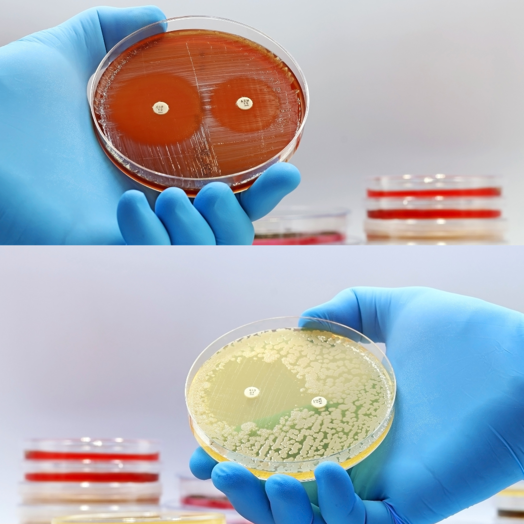 Bahaya Kandungan Residu Antibiotik pada Bahan Pangan dari Hewan Ternak ...